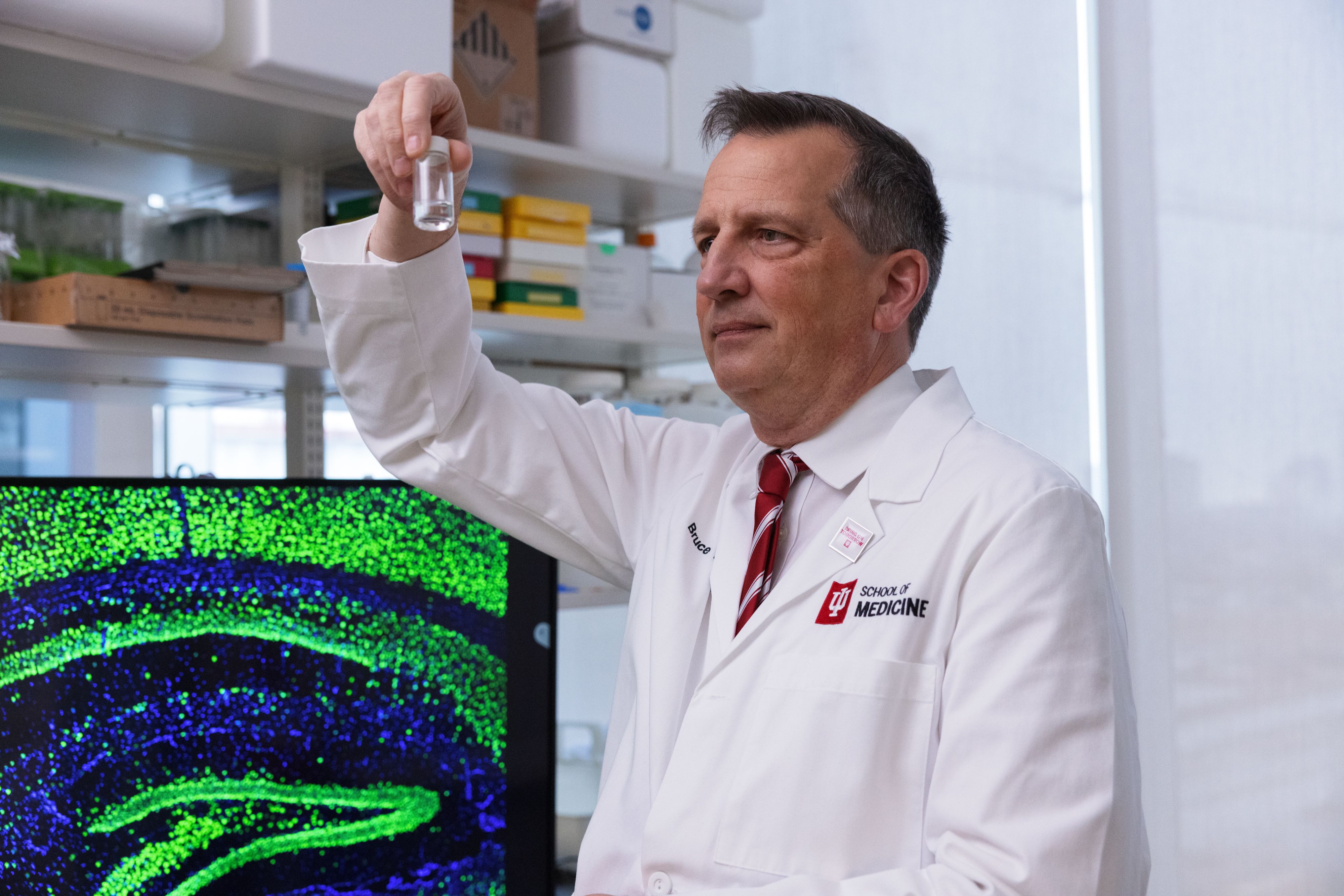 Indiana University: A national powerhouse in Alzheimer’s research ...